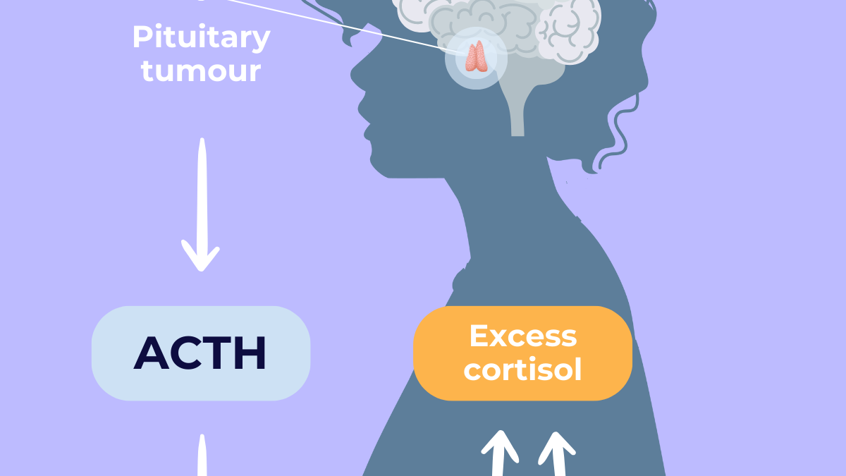 Cushing Syndrome Causes