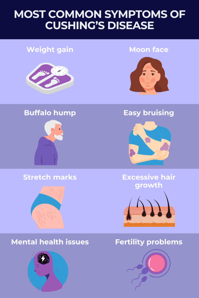 Cushing’s disease symptoms | Cushing's Disease News